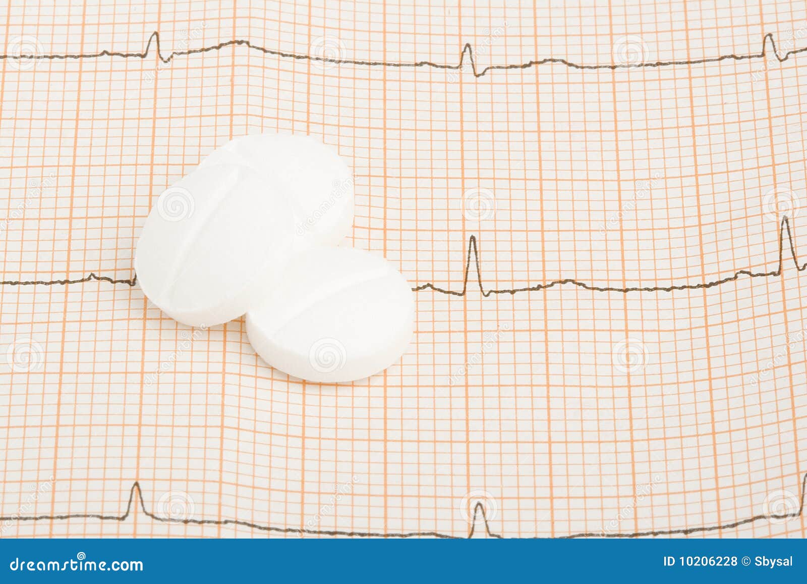 ECG Picture. Image: 10206228