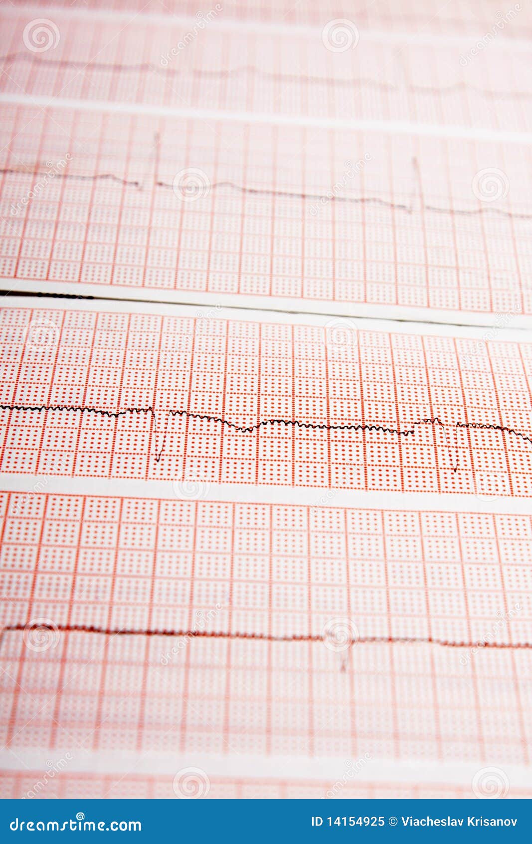 ECG Picture. Image: 14154925