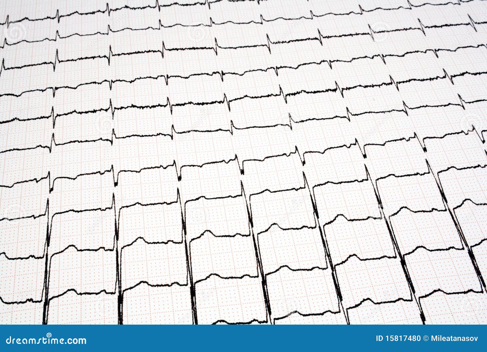 ECG stock photo. Image of diagram, diagnose, chest, electrocardiogram ...