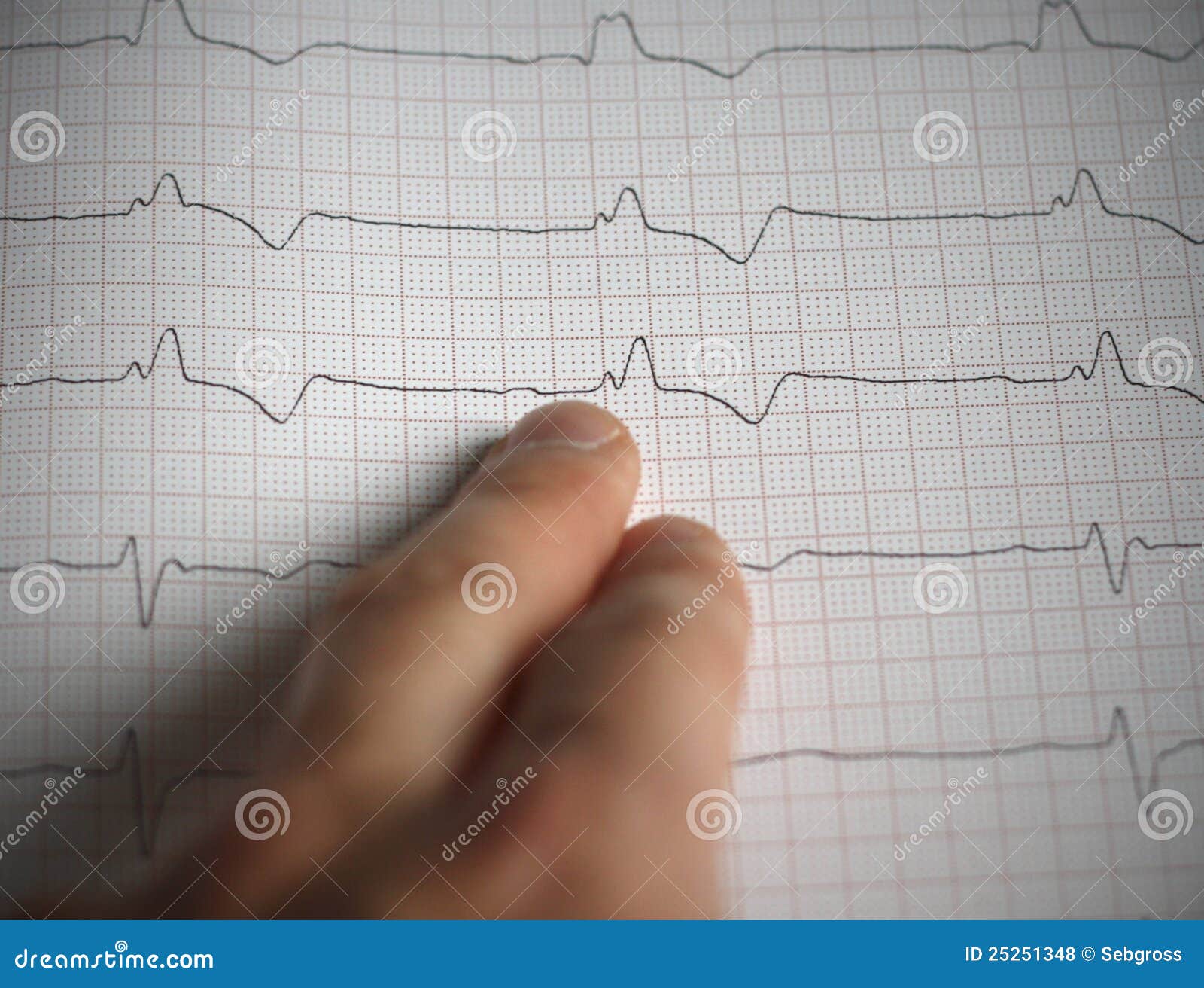 Ecg stock photo. Image of technology, pattern, medical - 25251348