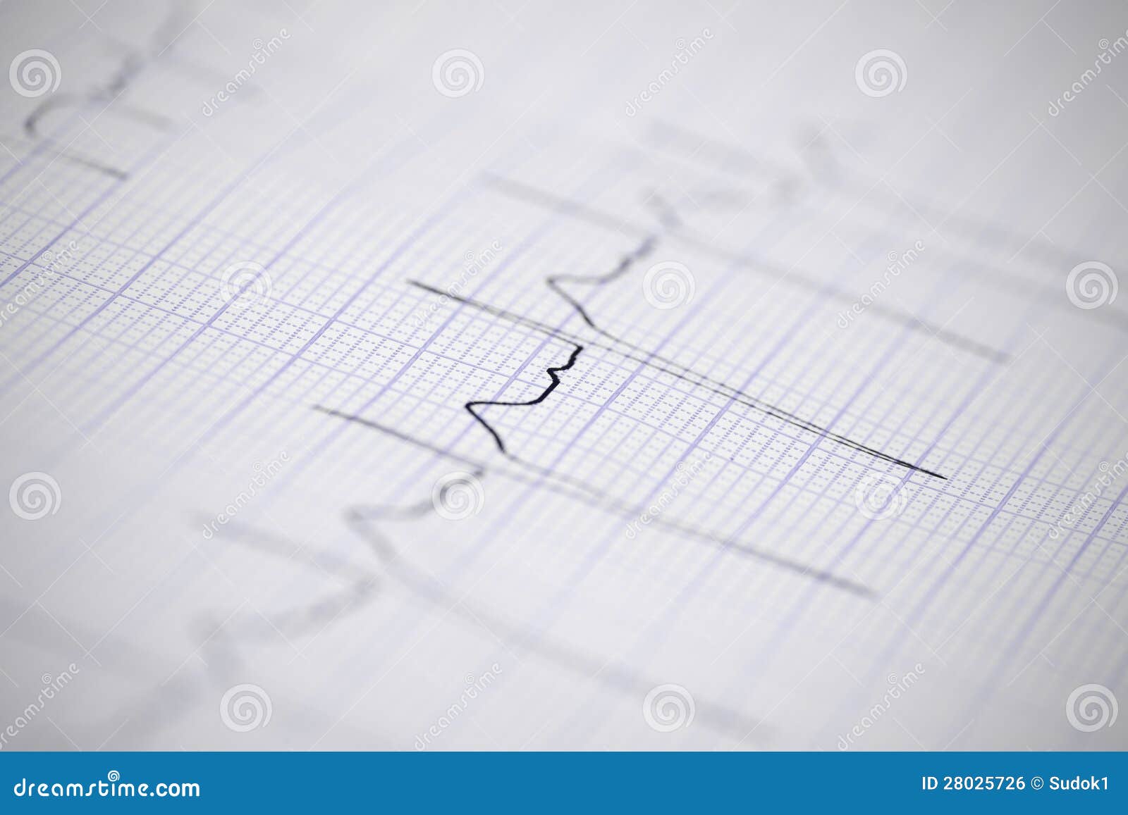 ECG stock photo. Image of pattern, graphic, closeup, frame - 28025726