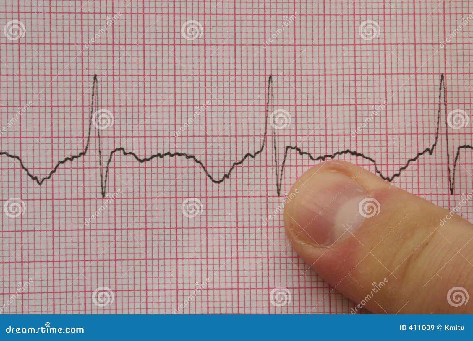 ECG #3 stock image. Image of examination, electric, cardiological - 411009