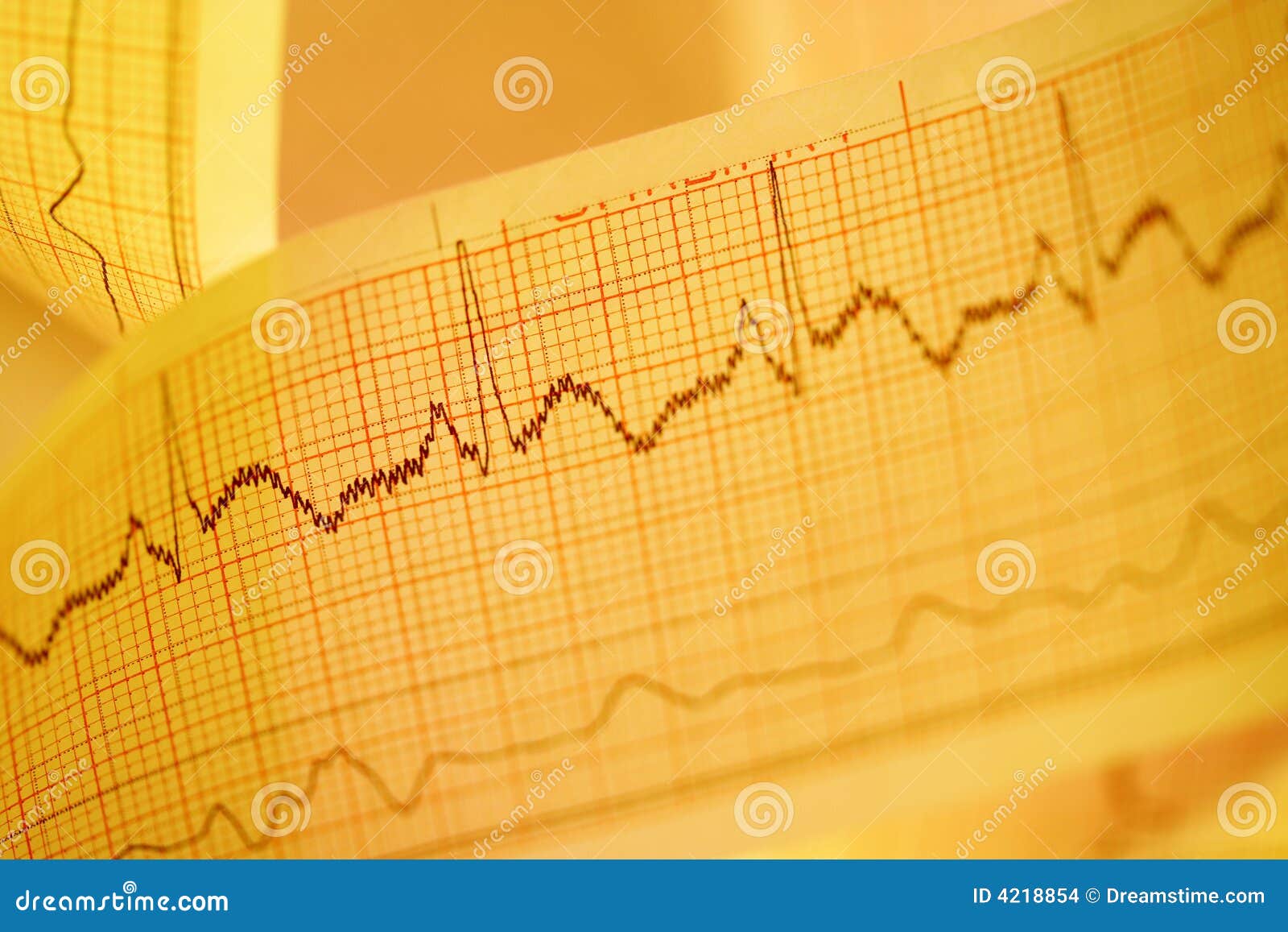ECG stock photo. Image of heartbeat, tests, result, analysis - 4218854