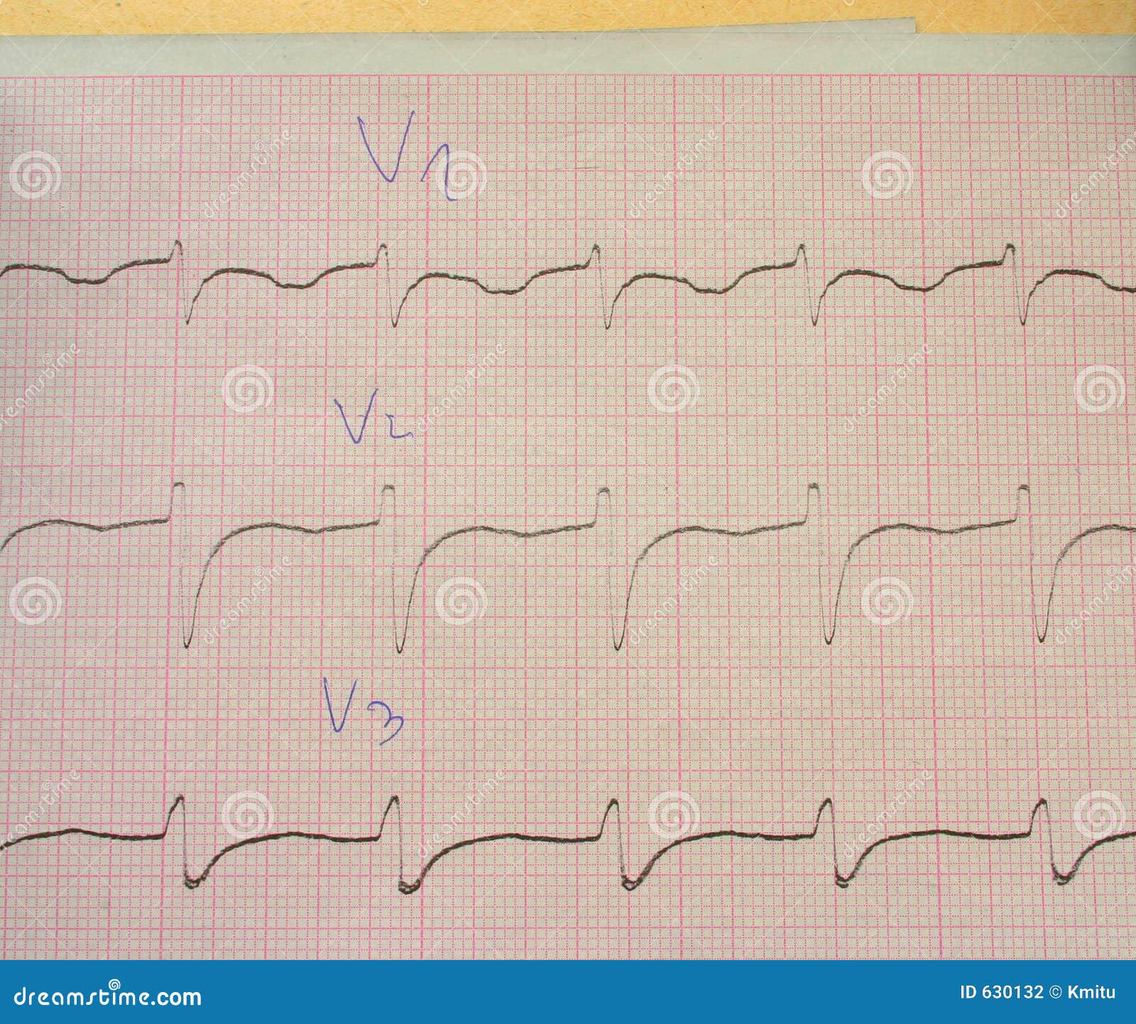 ECG stock photo. Image of analysis, cardiological, graph - 630132