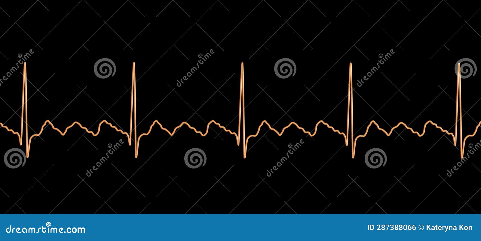 ECG In Atrial Flutter, 3D Illustration | CartoonDealer.com #287388066