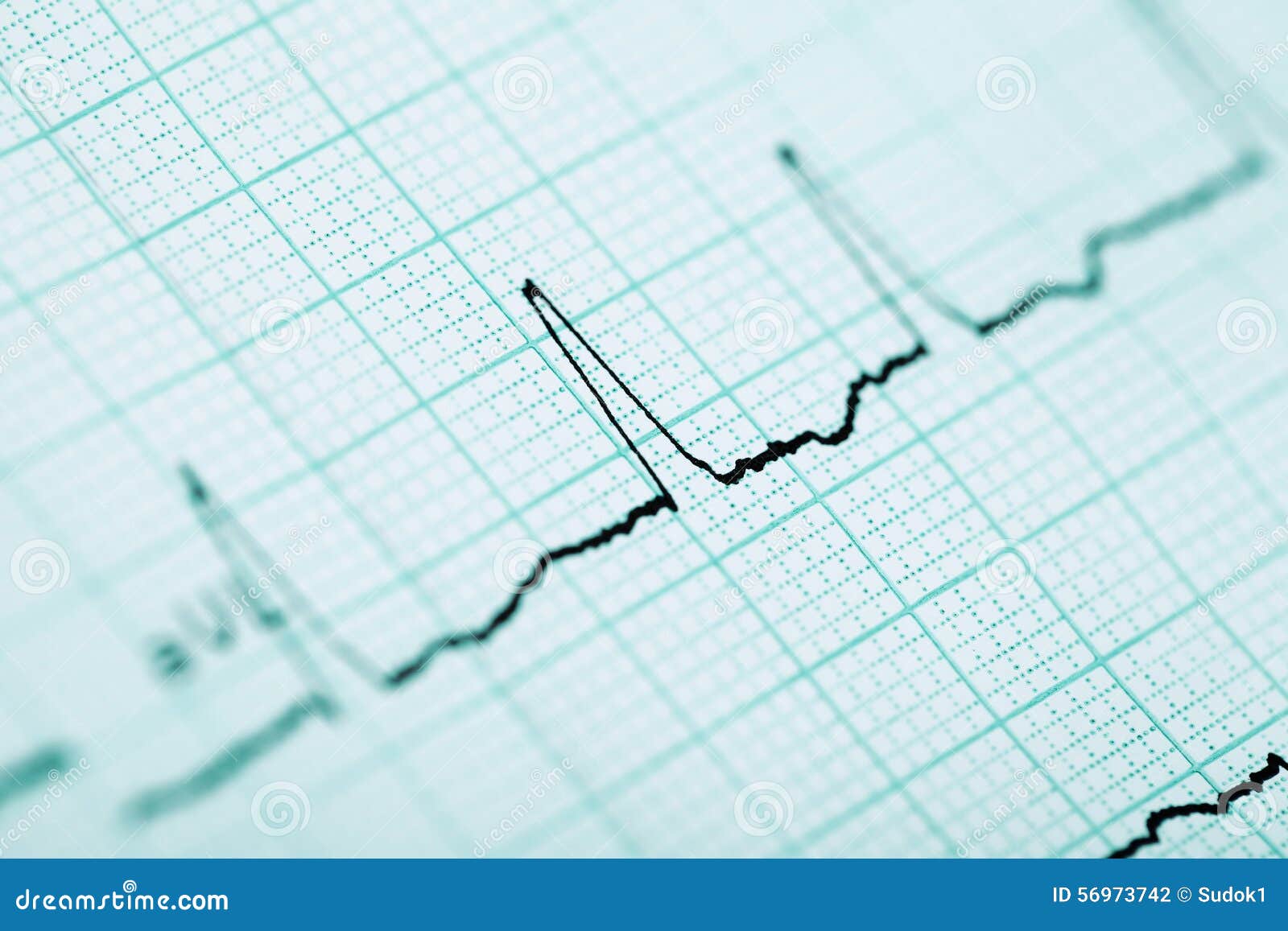 ECG background stock photo. Image of emergency, cardiology - 56973742