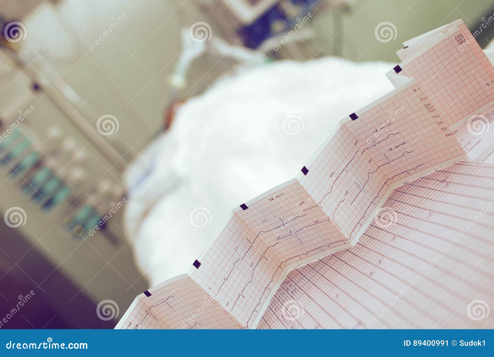 ECG Chart on the Background of the Patient Bed Stock Image - Image of ...
