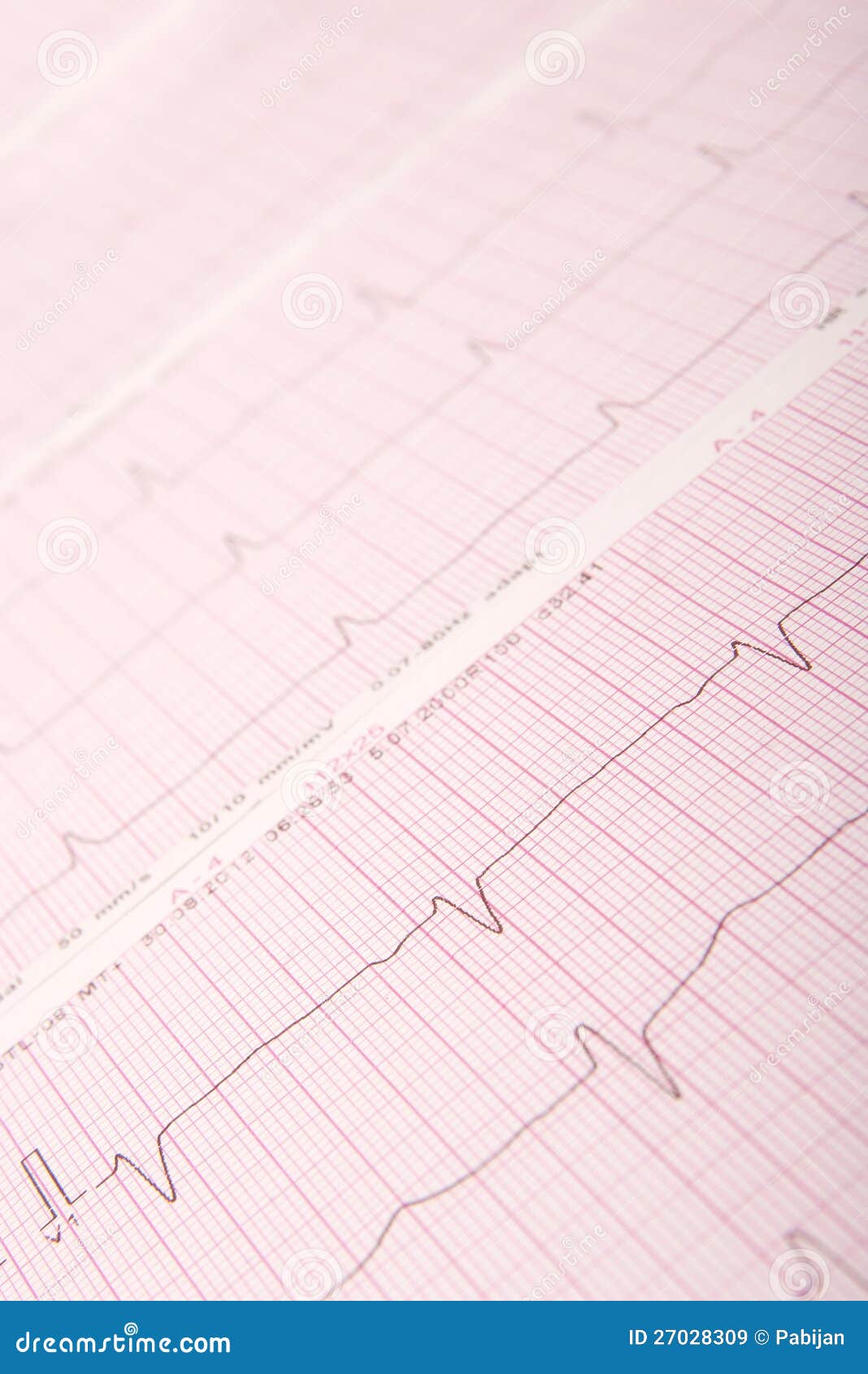 ECG Chart (ECG Results) Stock Image | CartoonDealer.com #27028309