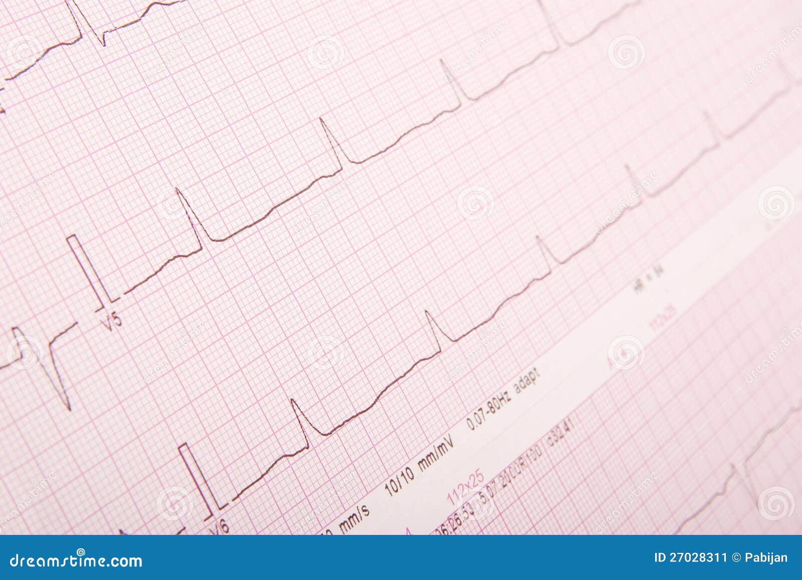 ECG chart (ECG results) stock image. Image of attributes - 27028311