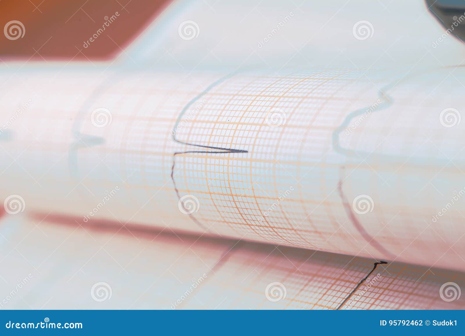 ECG chart on the table stock photo. Image of diagnostics - 95792462