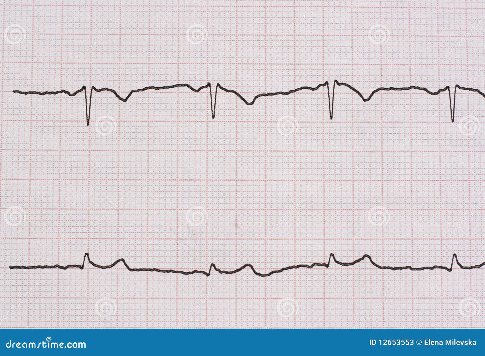 Ecg d'Ekg/- fond médical image stock. Image du médecine - 12653553