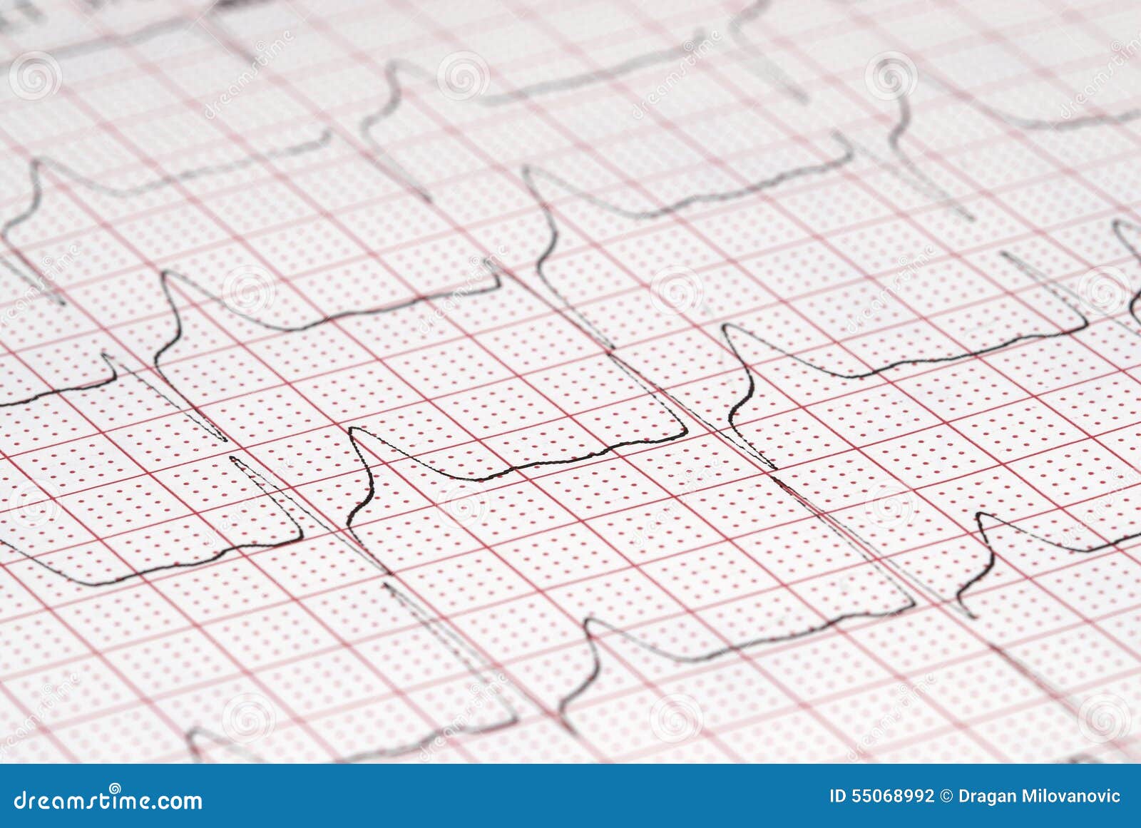 ECG diagram stock photo. Image of graph, cardiology, hospital - 55068992