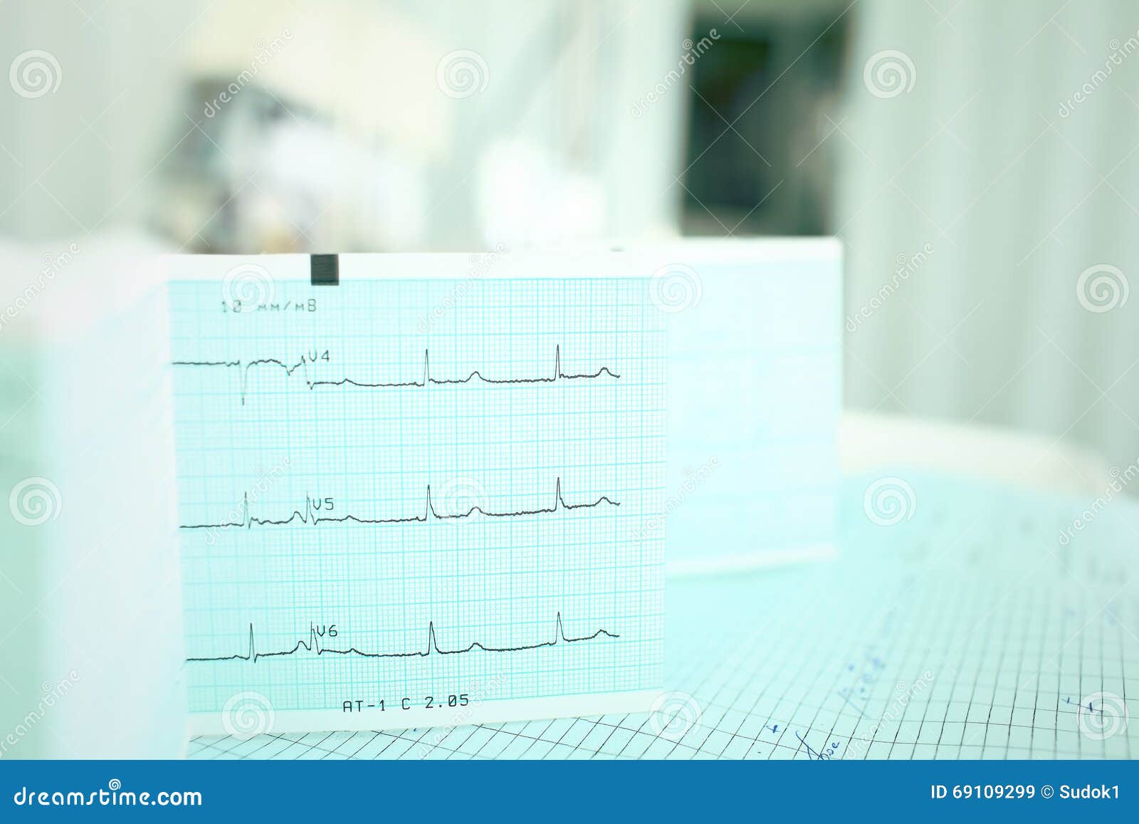ECG on the doctors table stock image. Image of background - 69109299