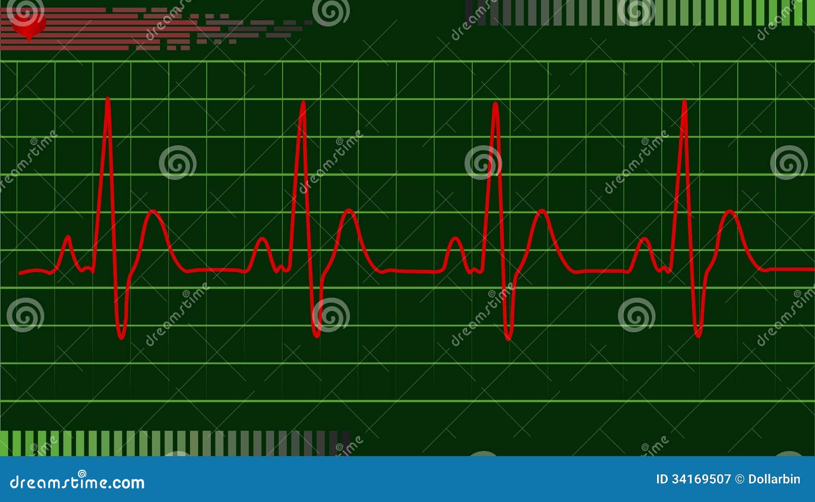 ECG EKG stock illustration. Illustration of attack, electrocardiogram ...