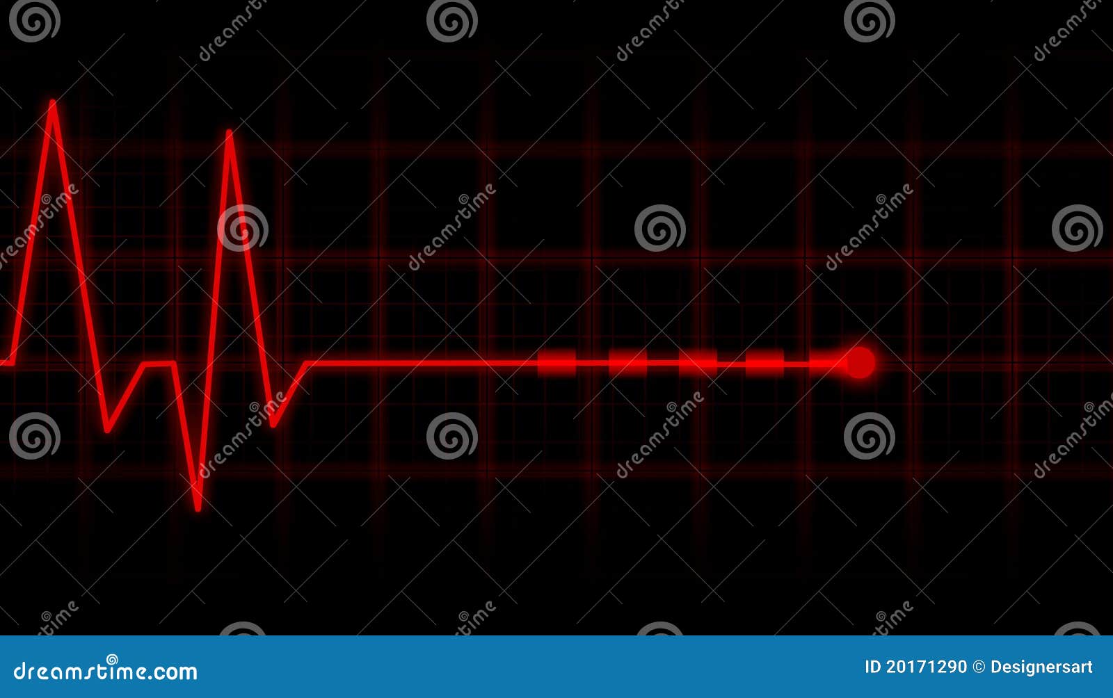 ECG Electrocardiogram Picture. Image: 20171290