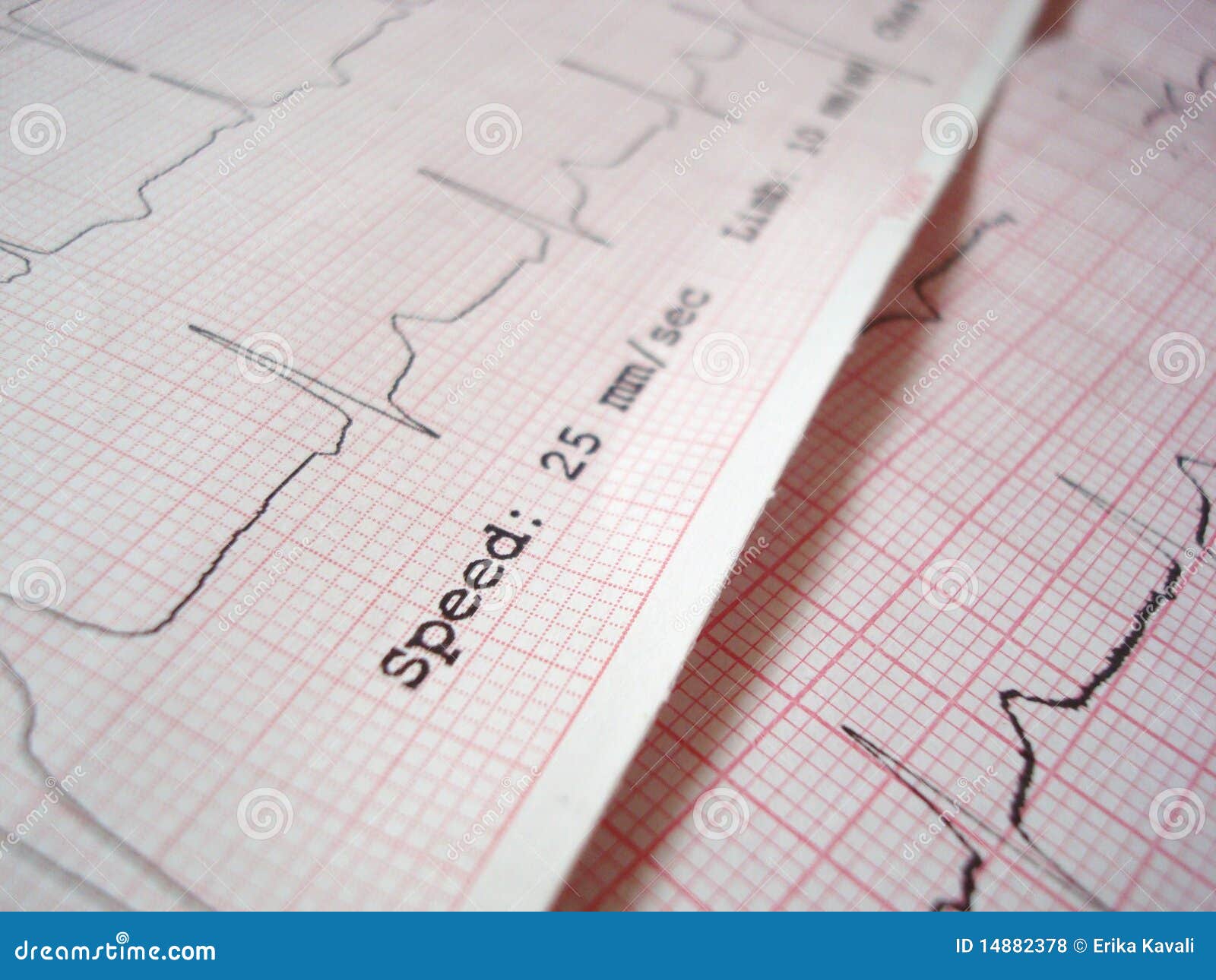 ECG electrocardiography stock photo. Image of graph, intervals - 14882378