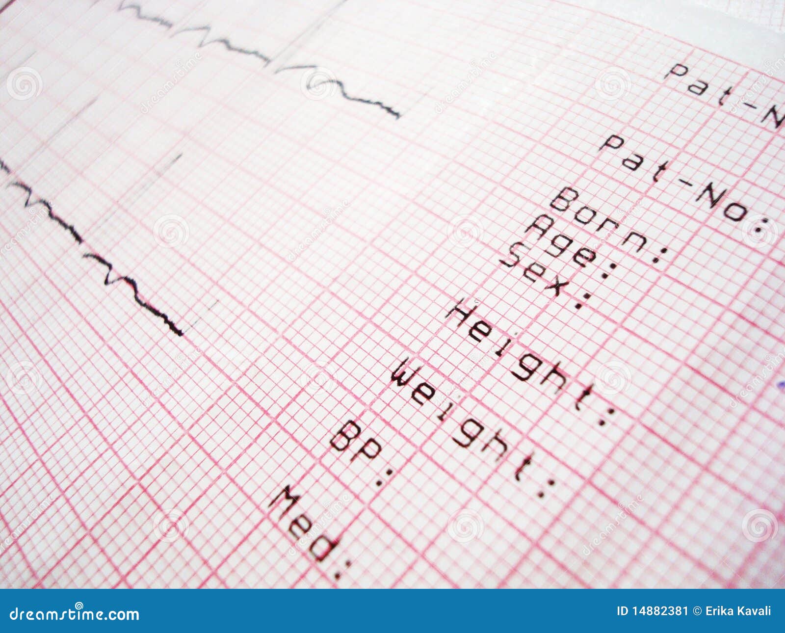 ECG electrocardiography stock image. Image of medication - 14882381