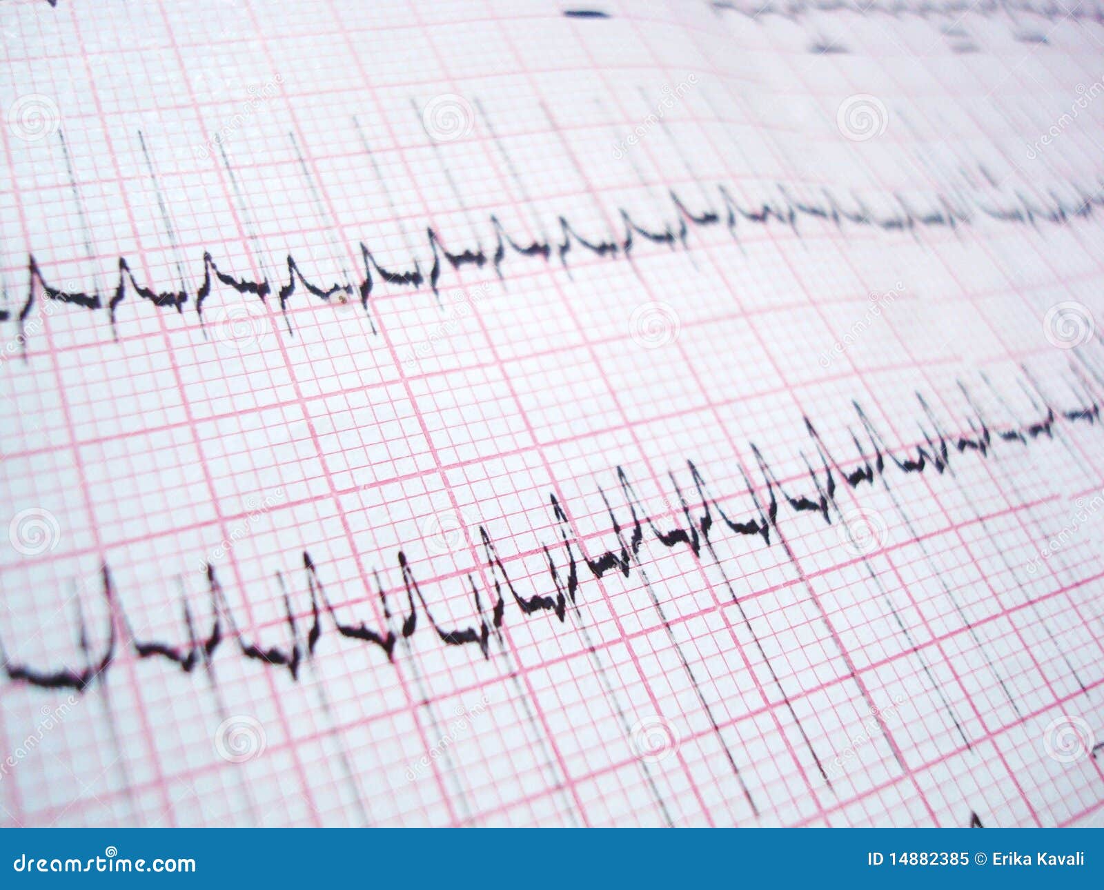 ECG electrocardiography stock image. Image of record - 14882385