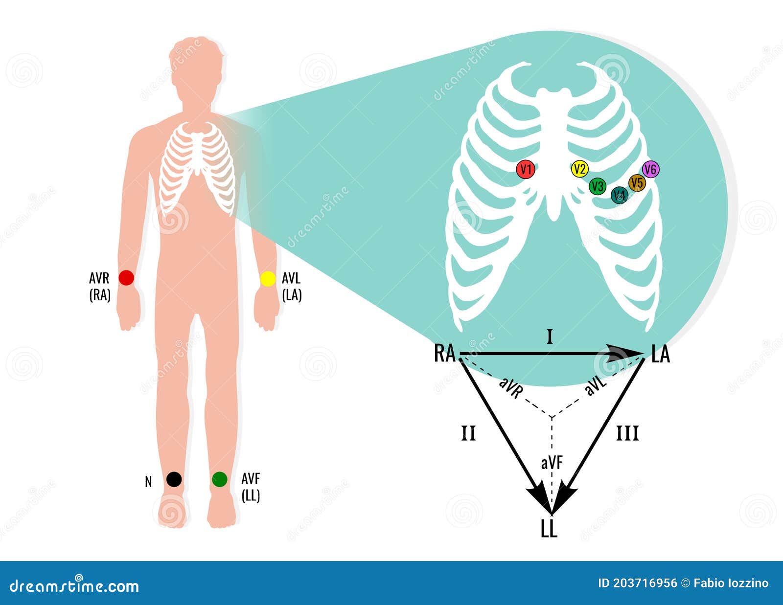 Ecg Electrode Position Illustration With Ecg Limb Leads. Useful For ...