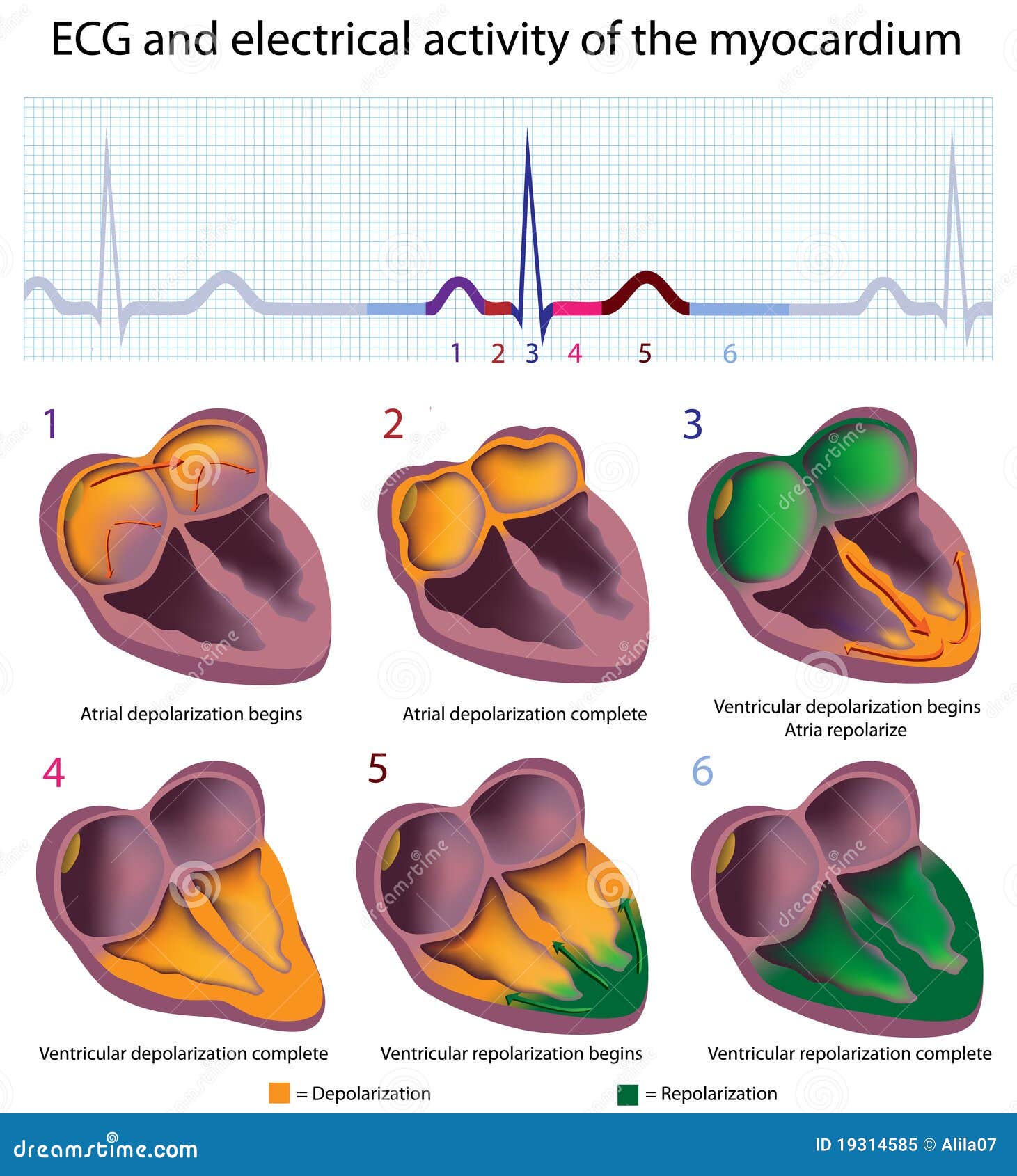 ECG explicado ilustração do vetor. Ilustração de médico - 19314585