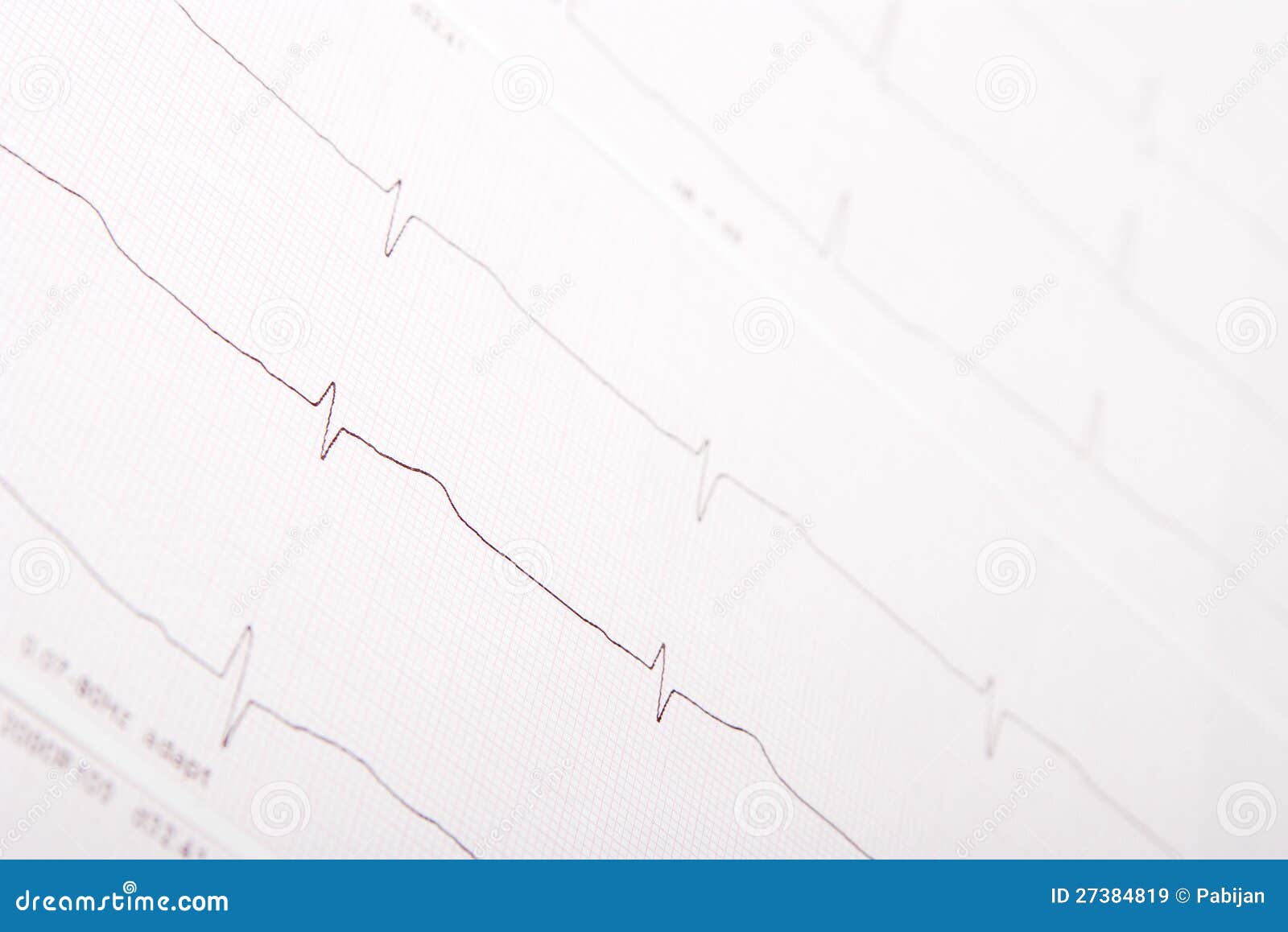 Ecg- Grafiek (elektrocardiogram) Stock Afbeelding - Image of medisch ...