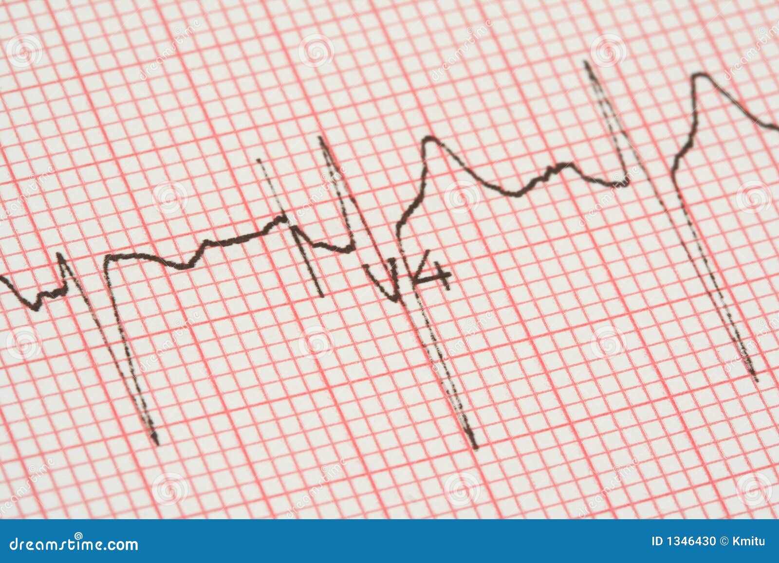 Ecg graph stock photo. Image of analysis, cardiologist - 1346430