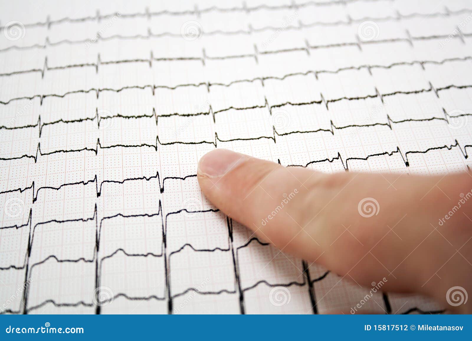 ECG graph stock photo. Image of electrocardiogram, analyze - 15817512