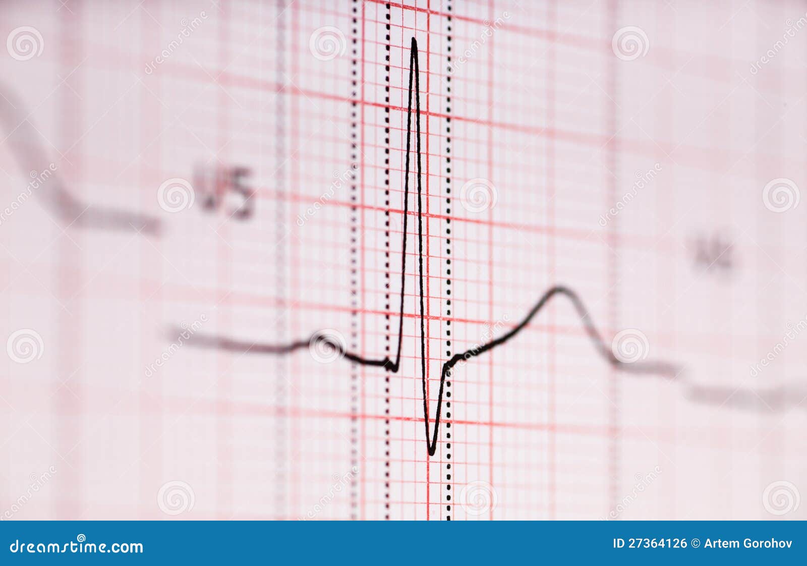 ECG graph stock photo. Image of analyzing, disease, healthy - 27364126