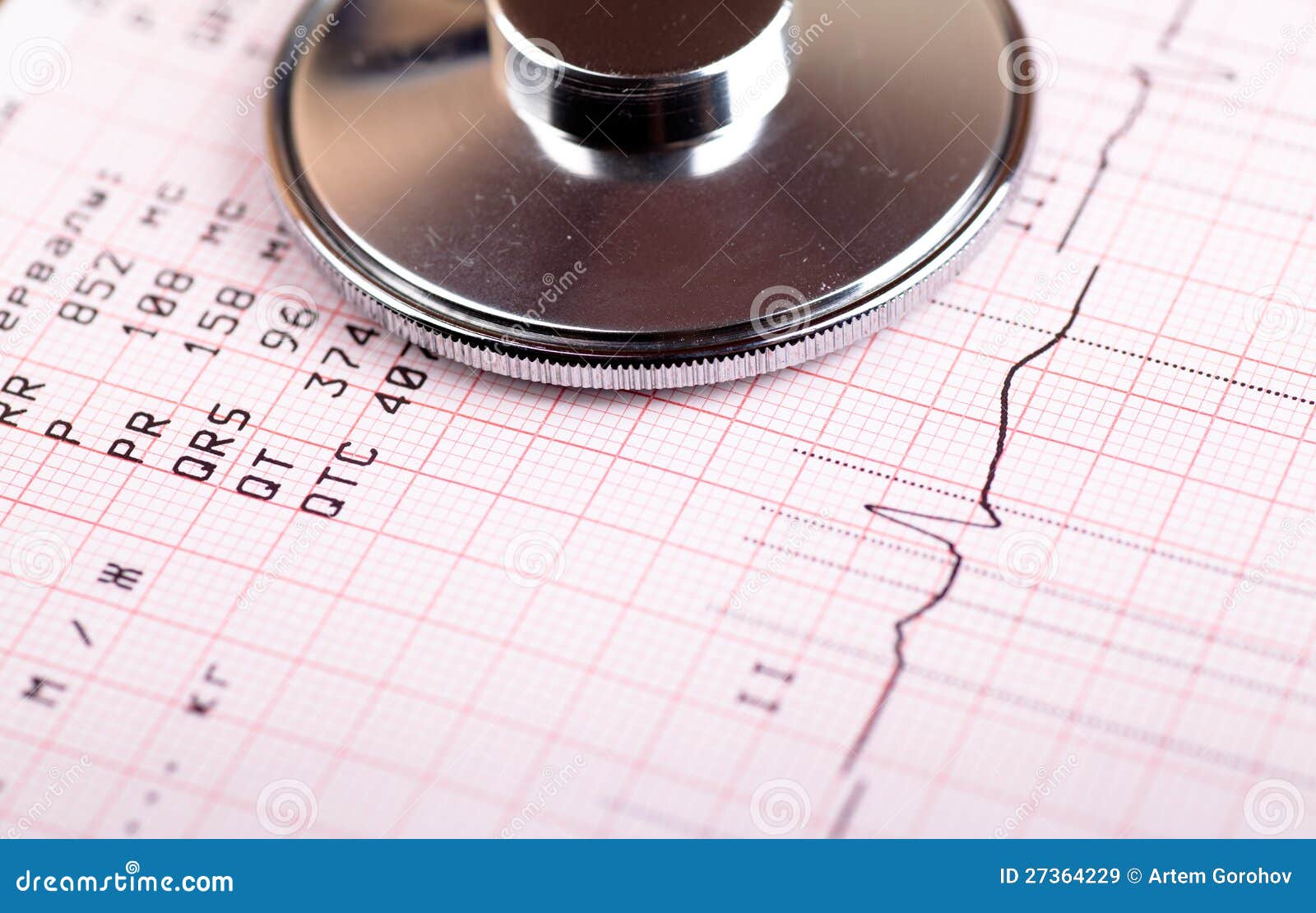 ECG graph stock image. Image of disease, illness, metal - 27364229