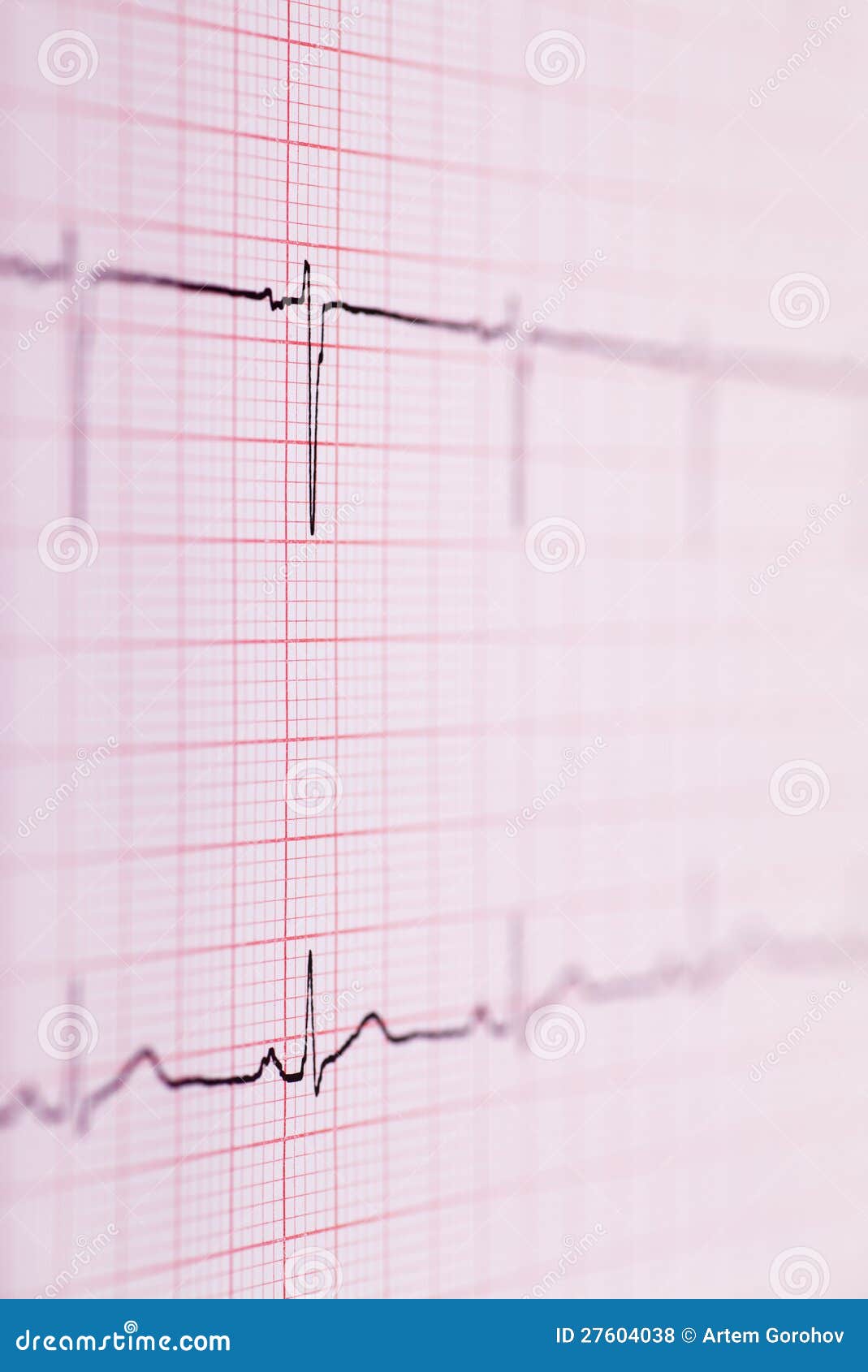 ECG graph stock photo. Image of laboratory, chart, healthcare - 27604038