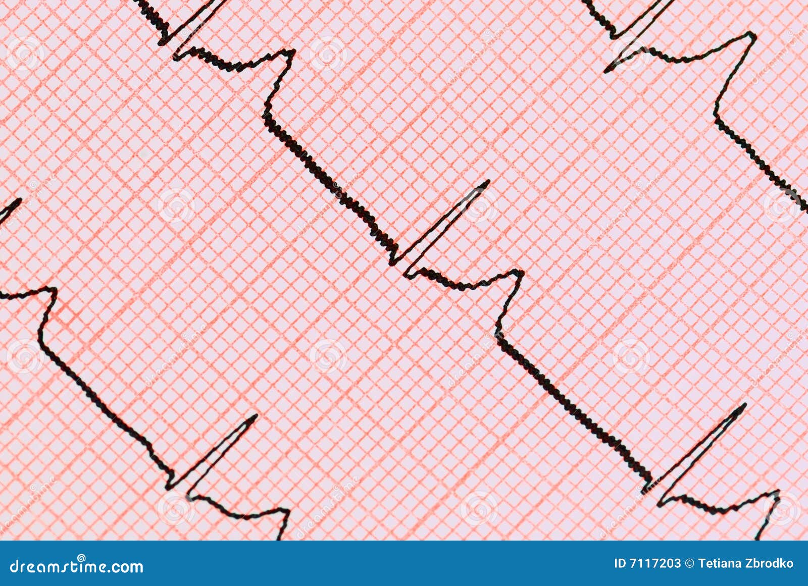 ECG graph stock image. Image of pulse, medicine, stability - 7117203