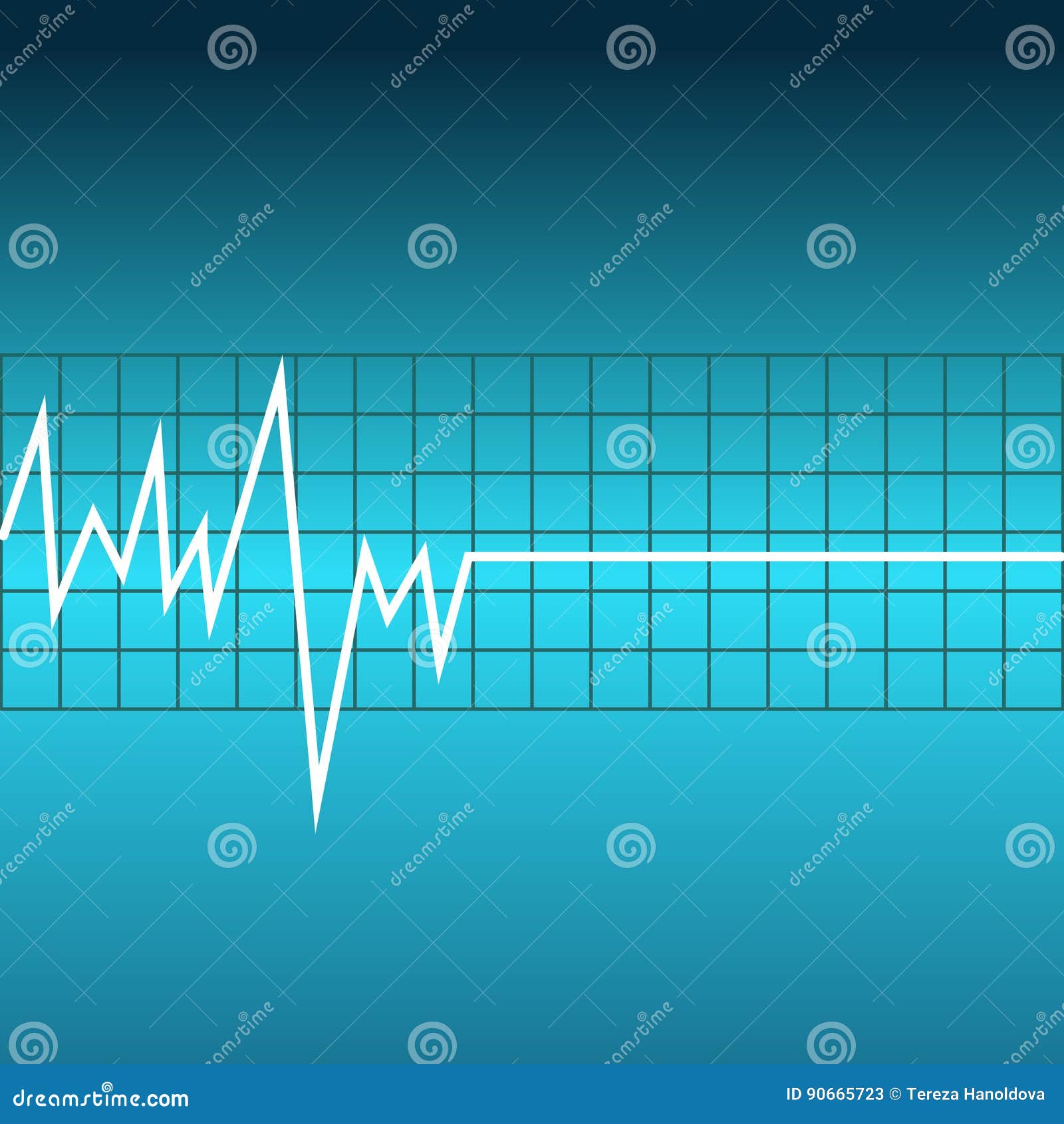 Ecg Graph On Blue Background Cartoon Vector | CartoonDealer.com #90665723