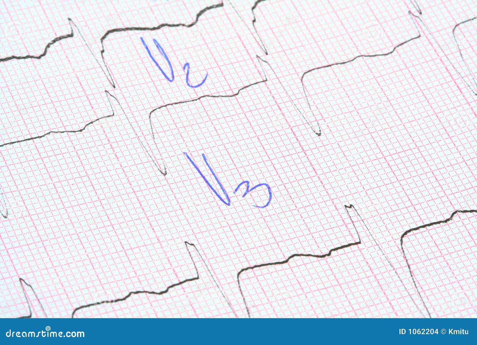 ECG Graph With Doctor Notes Stock Photo | CartoonDealer.com #1062204