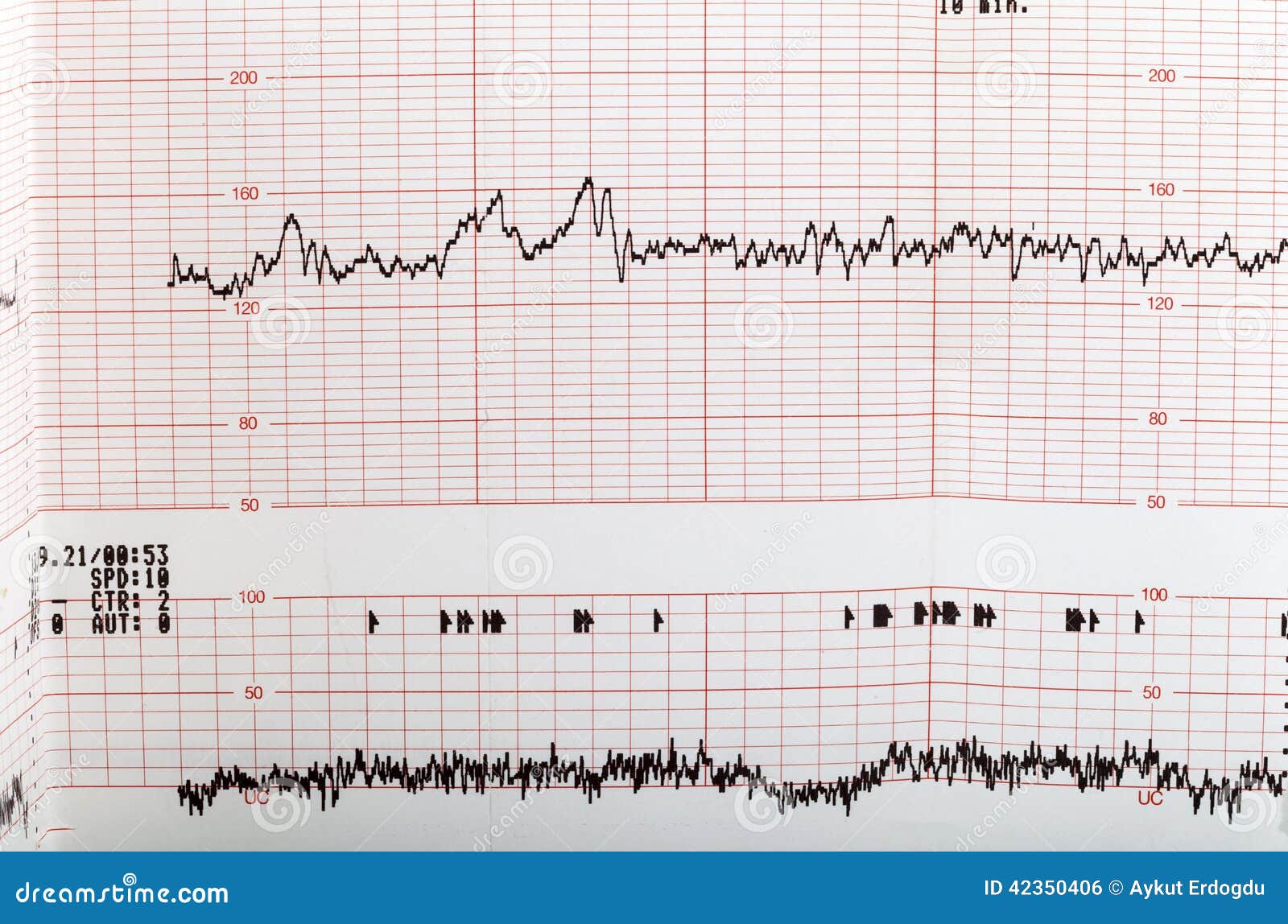 Ecg graph stock photo. Image of care, heart, analyzing - 42350406