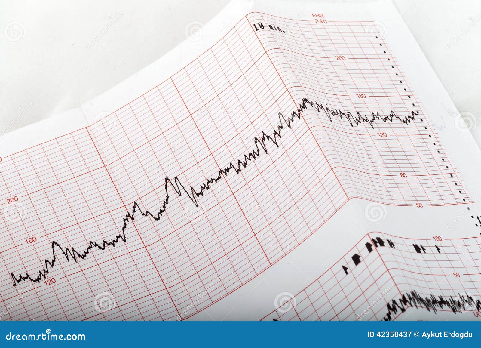 Ecg graph stock image. Image of progress, electrocardiogram - 42350437