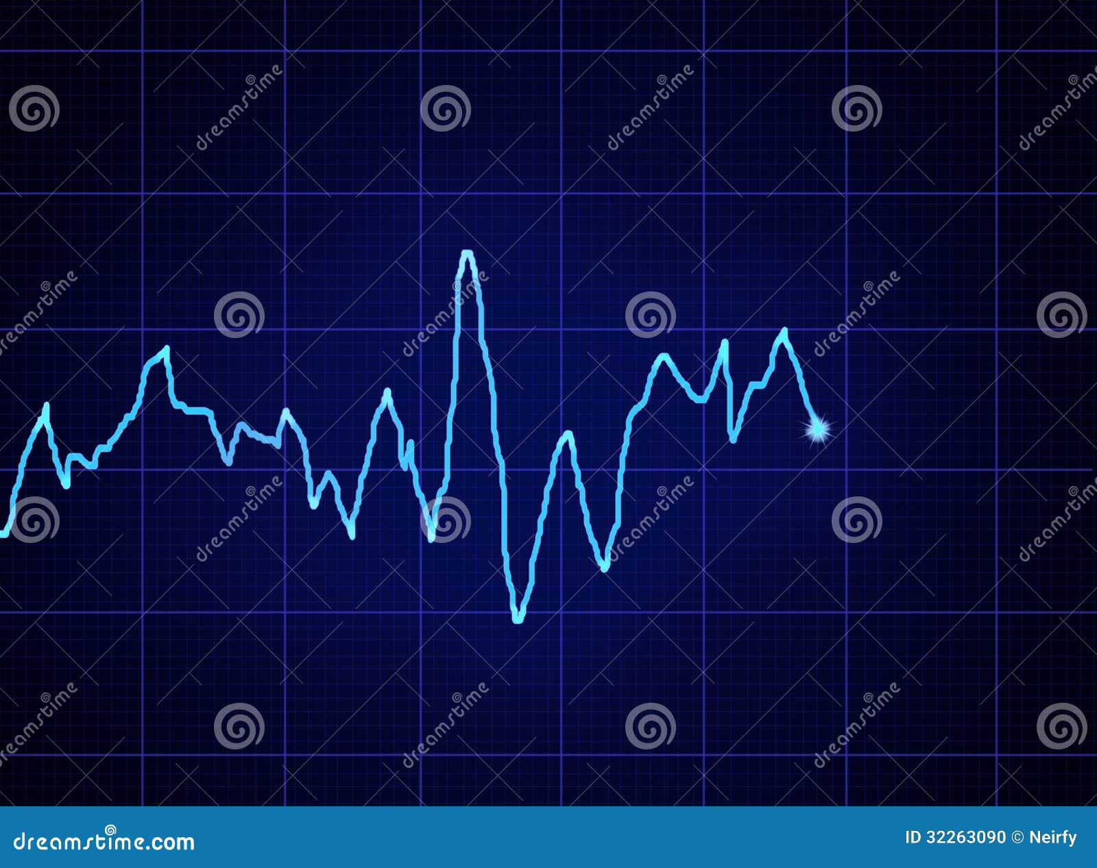 ECG Graph Stock Photo - Image: 32263090
