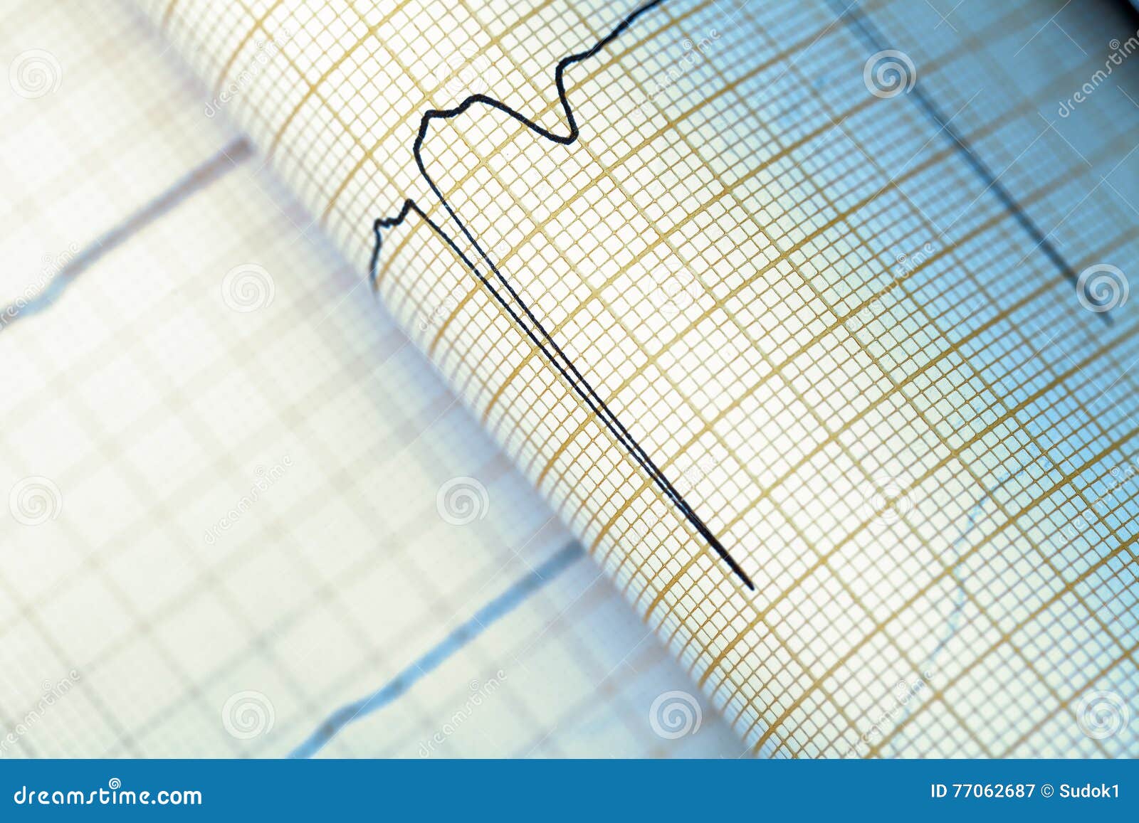 139 Medical Alert Graph Stock Photos - Free & Royalty-Free Stock Photos ...