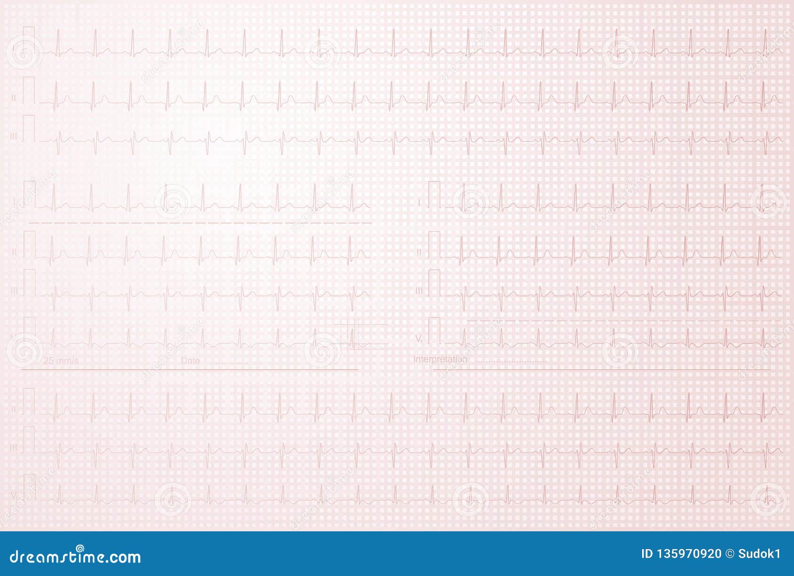 ECG Line in the Squared Notebook Stock Illustration - Illustration of ...