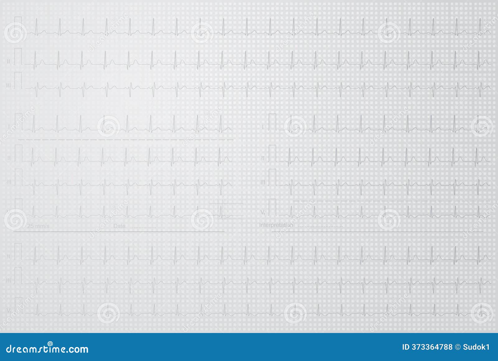 Ecg Cartoons, Illustrations & Vector Stock Images - 29747 Pictures to ...