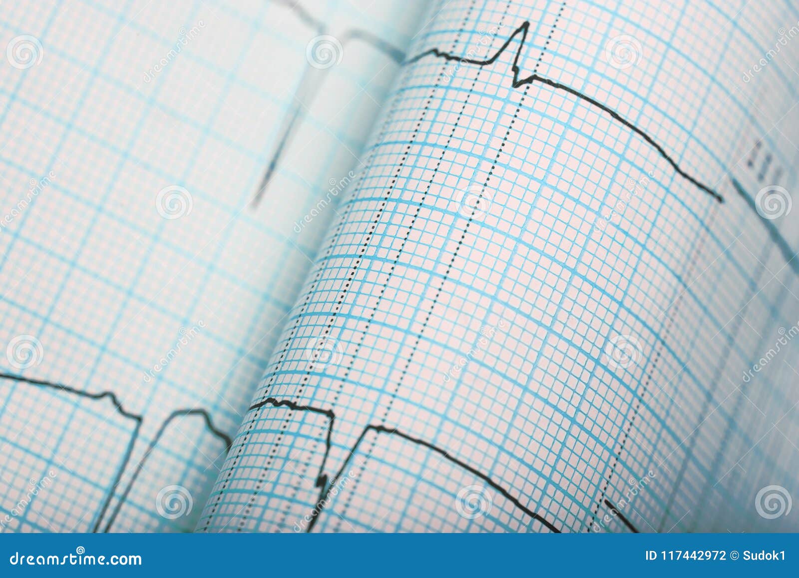 Bended Ecg Paper On The Background Of Hospital Room Royalty-Free Stock ...