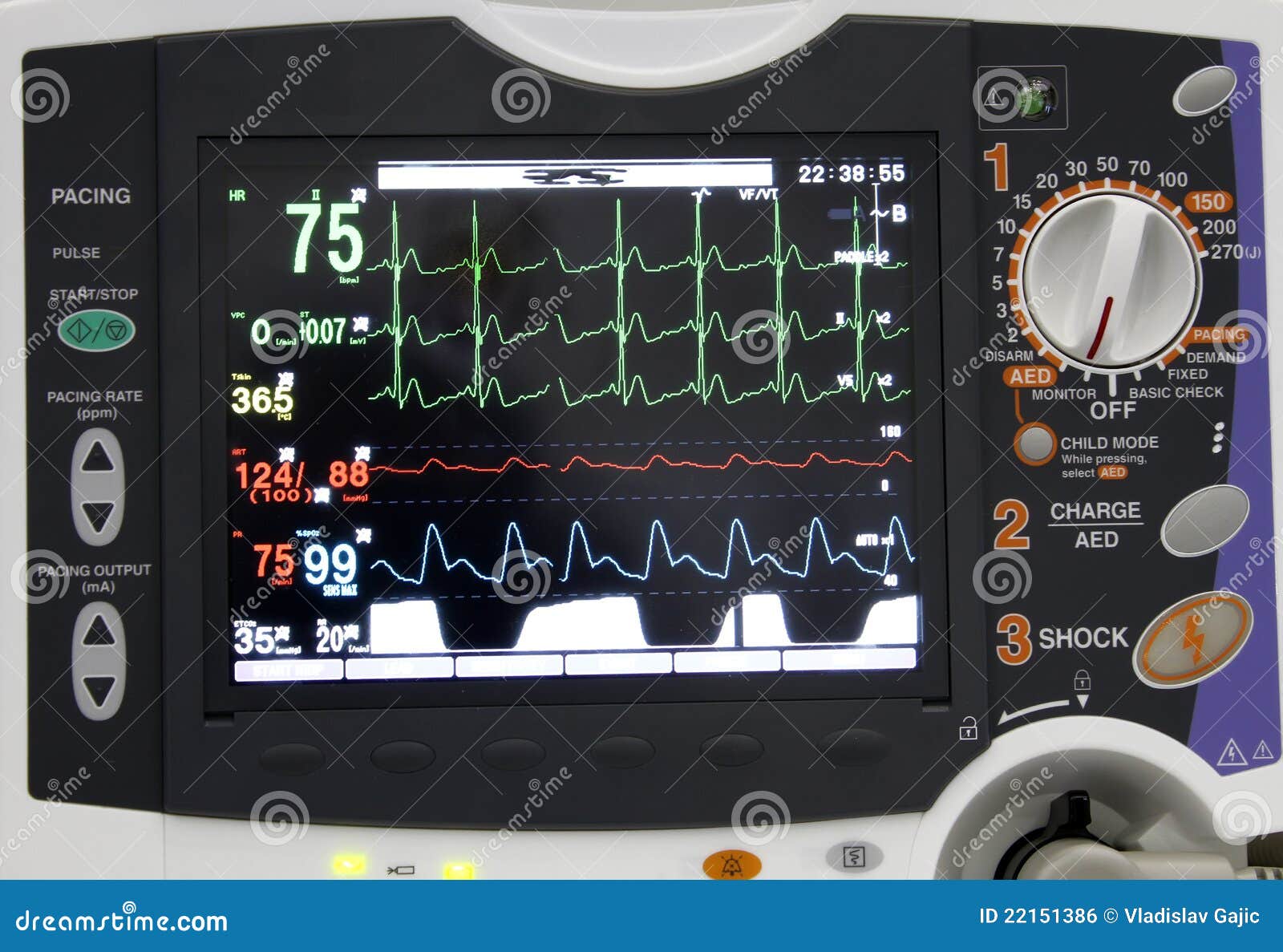 ECG monitor stock photo. Image of healthcare, emergency - 22151386