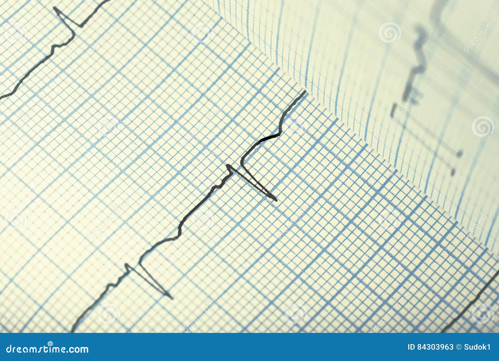 ECG Paper As Medical Background Stock Image - Image of healthcare, line ...
