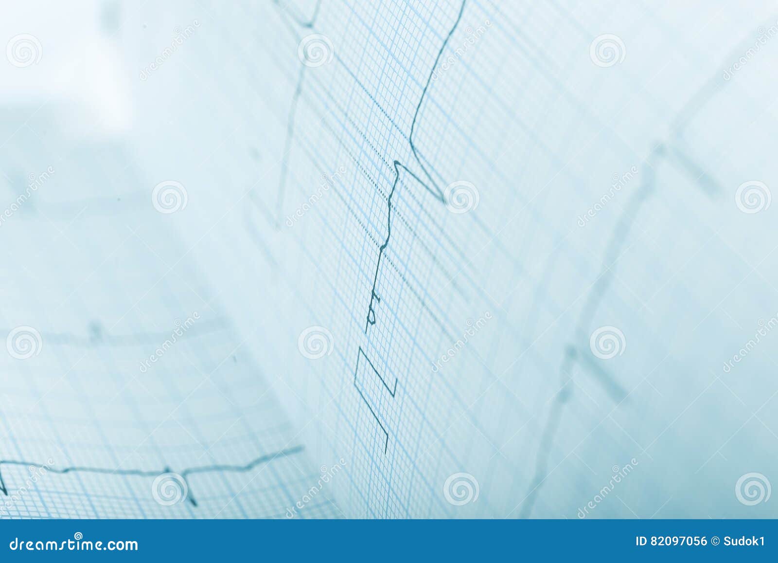 ECG Paper Record, Medical Background Stock Photo - Image of concept ...