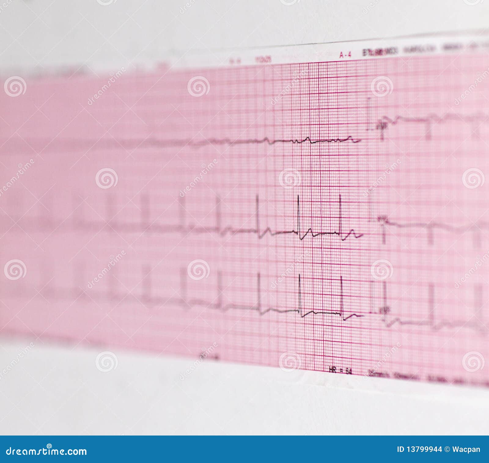 ECG Print Picture. Image: 13799944