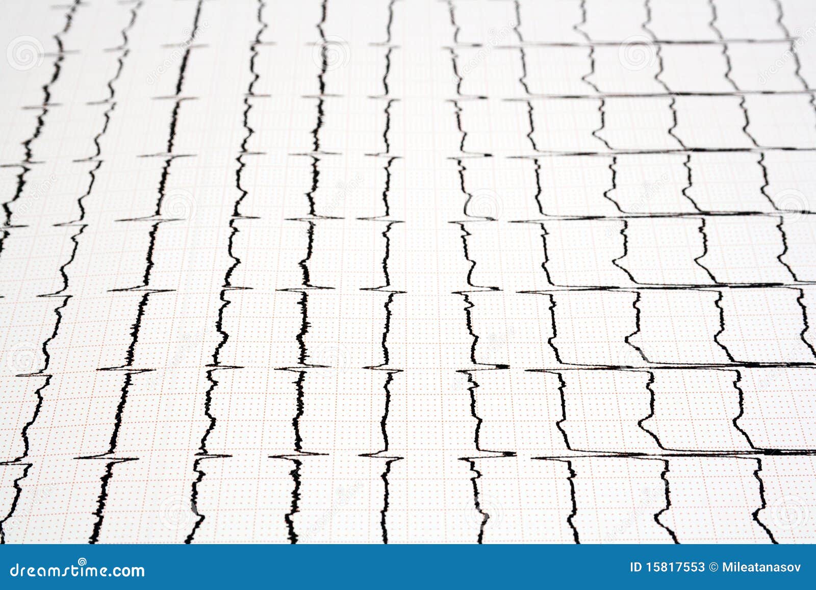 ECG print stock image. Image of electrocardiogram, pulse - 15817553