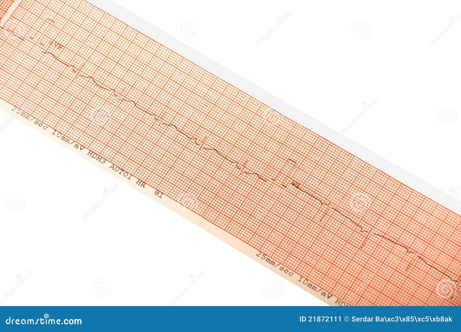 ECG print stock image. Image of blood, diagnose, cardiologist - 21872111