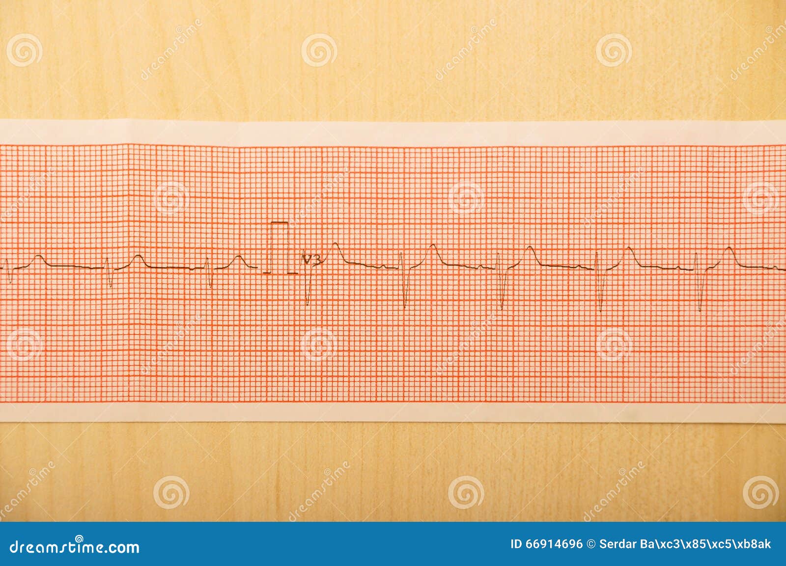 ECG print stock photo. Image of cardiologist, chart, heart - 66914696