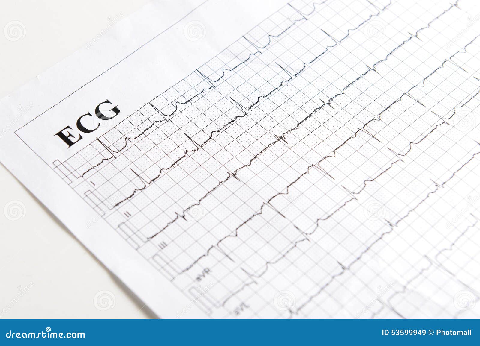 ECG-printout stock afbeelding. Image of cardiovasculair - 53599949