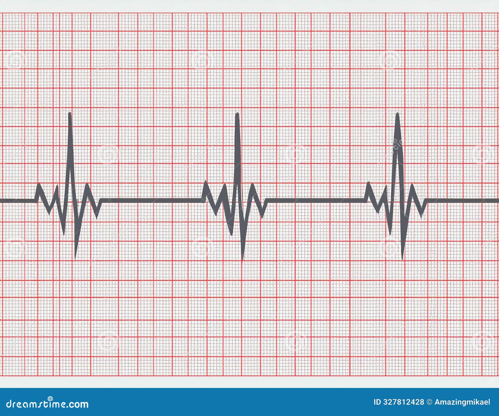 Pulse Wave Doppler Ultrasound Examination. Stock Image | CartoonDealer ...