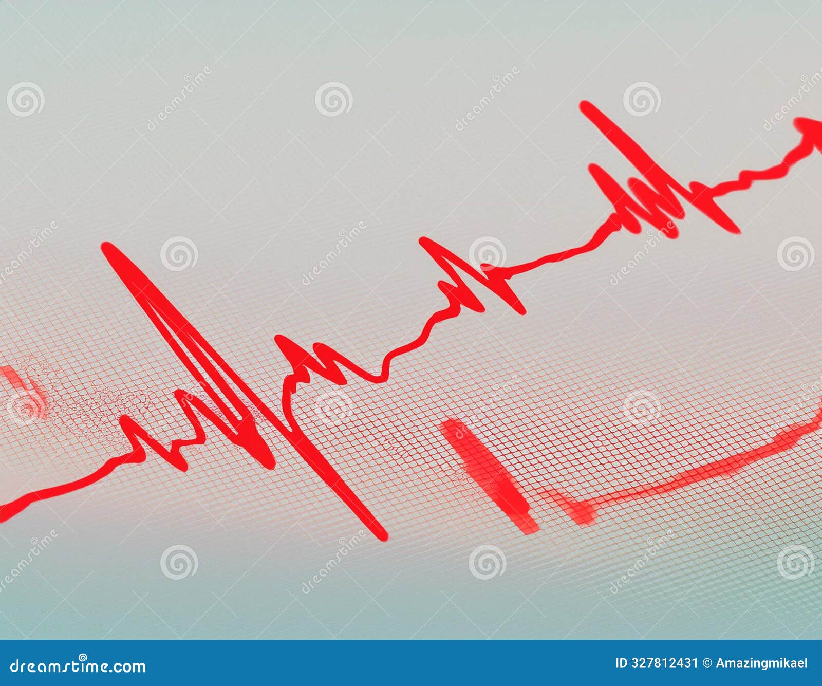 Pulse Wave Doppler Ultrasound Examination. Stock Image | CartoonDealer ...